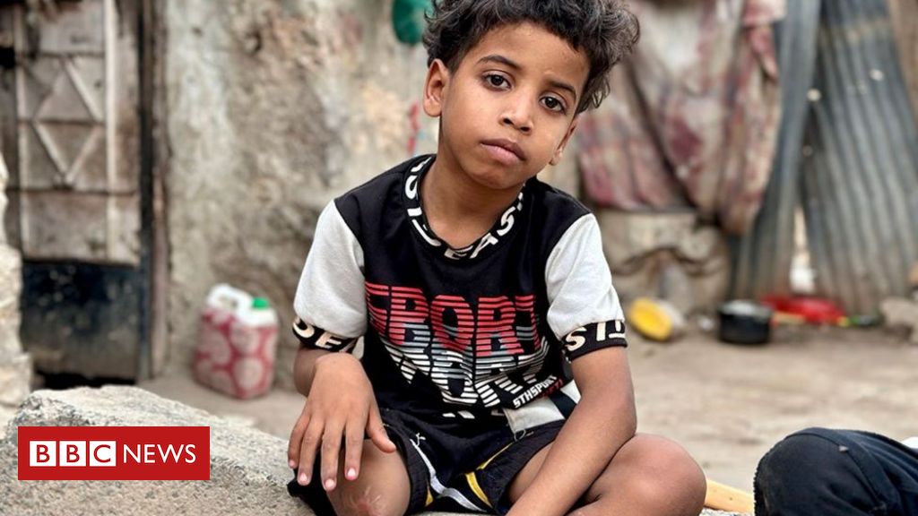 a-guerra-‘esquecida’-que-deixa-milhares-de-criancas-feridas-e-passando ...